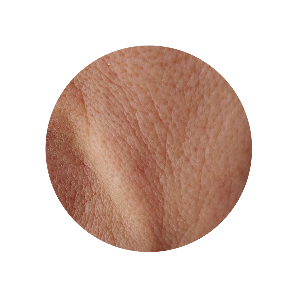 Menopausal Skin